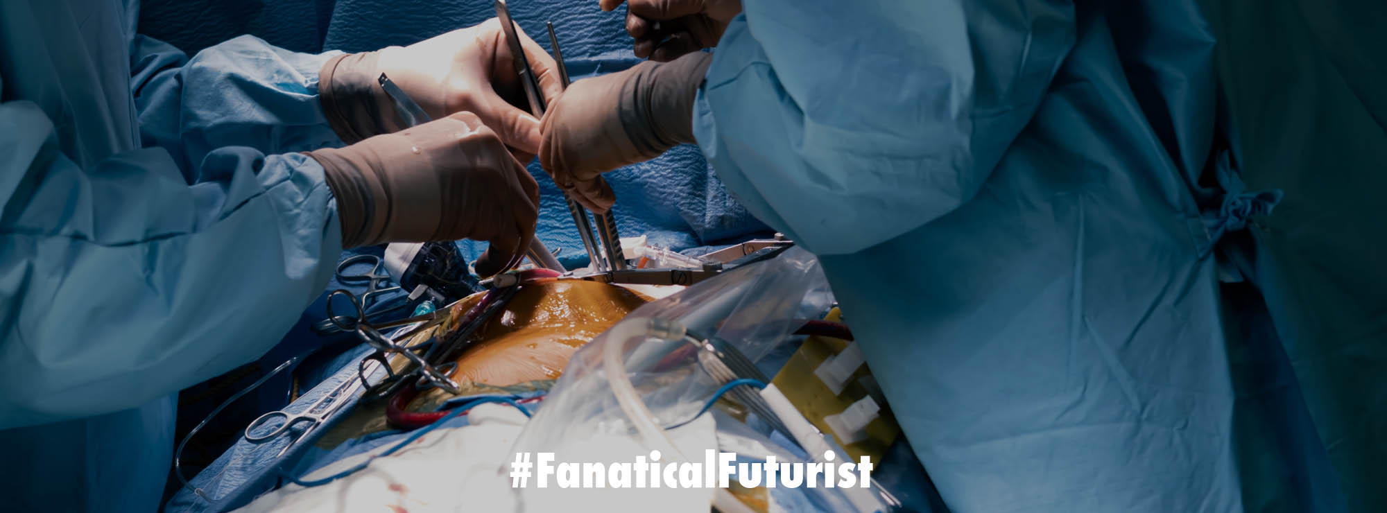 New AI imaging tech lets surgeons see through blood during surgery ...